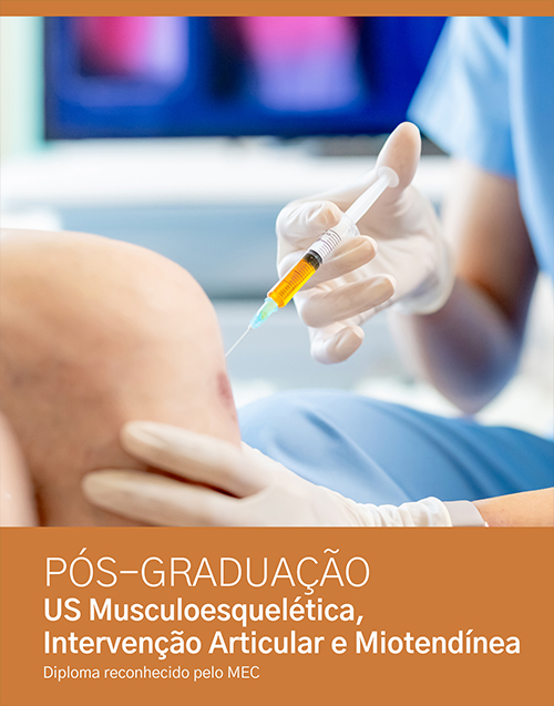 Teste - Nexus